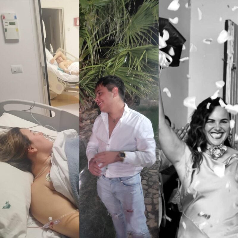 Concetta dona un rene al fratello Alessandro: una storia di amore e ...